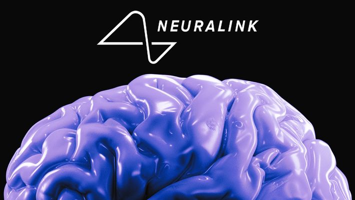 Neuralink d'Elon Musk Implante la Première Puce Cérébrale sur un Être ...